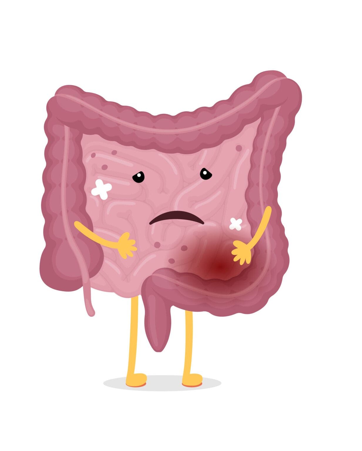 Intestines characters healthy and unhealthy comparison. Human intestine ...