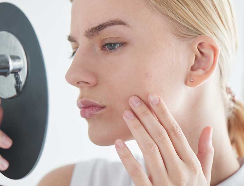 Could Your Skin Problems Be Connected To Your Liver? | Cabot Health