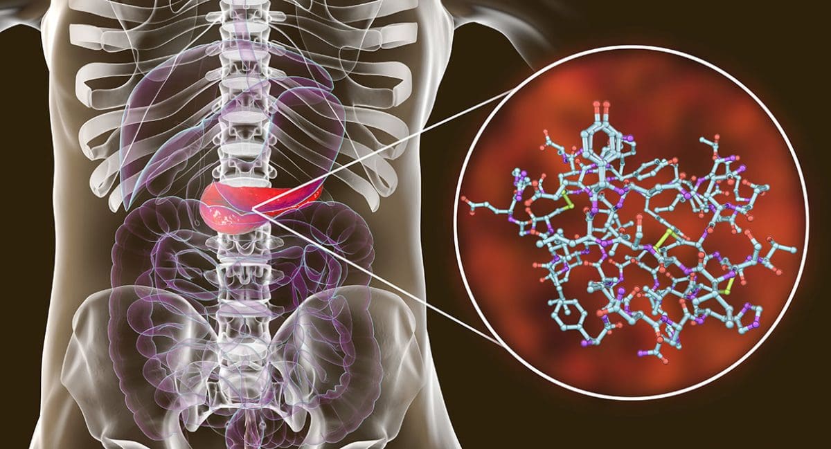 Fatty Pancreas: Do You Know the Risks? | Cabot Health
