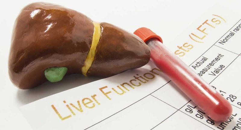 How To Read Your Liver Blood Tests | Cabot Health